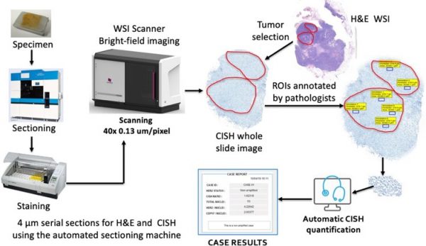 Automated CISH Quantification to determine the HER2 status of Breast Cancer Patients – Yamaguchi Lab