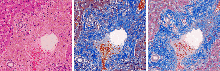 Pathology image analysis – Yamaguchi Lab