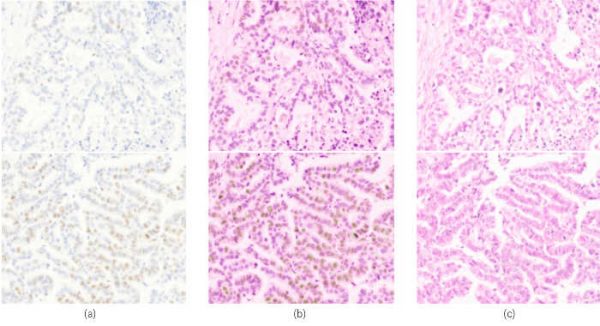 デジタル染色 – Yamaguchi Lab